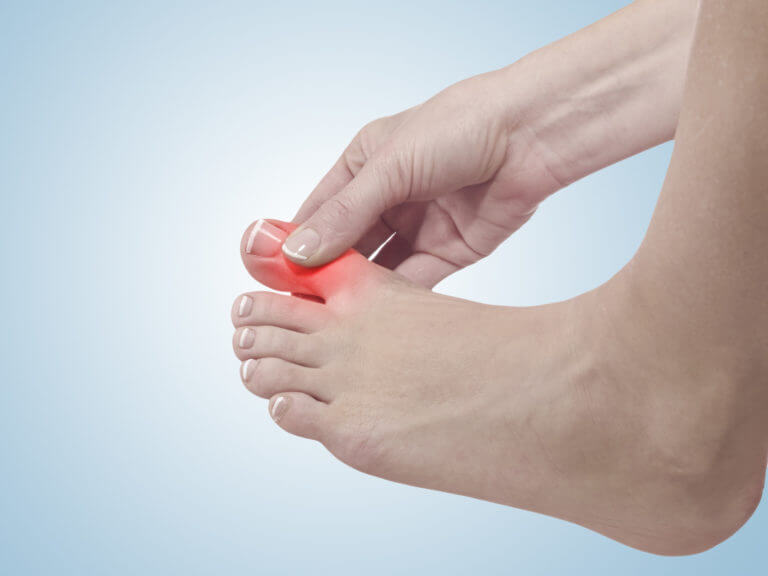 Arthritis symptoms in the toes | Family Foot & Ankle Centers