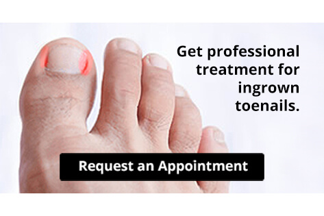 Are You Suffering From Ingrown Toenails? - Family Foot & Ankle Centers
