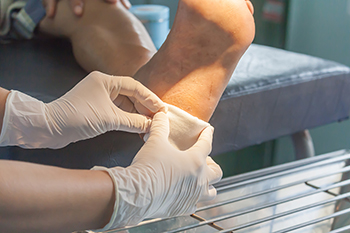 How to Care for Wounds on the Feet - Family Foot & Ankle Centers